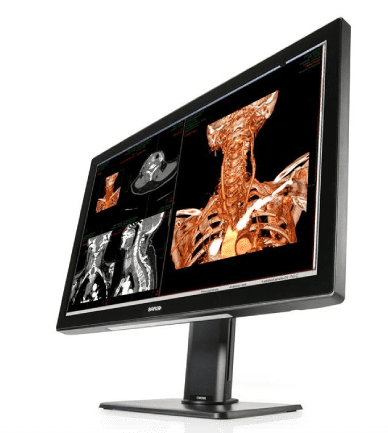 Monitores Barco - ITMATION