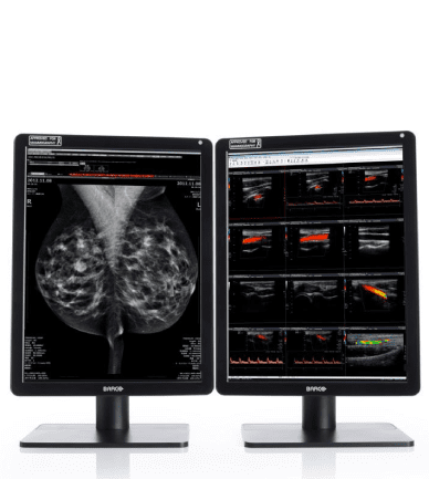 Monitores Barco - ITMATION