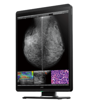 Monitores JVC - ITMATION